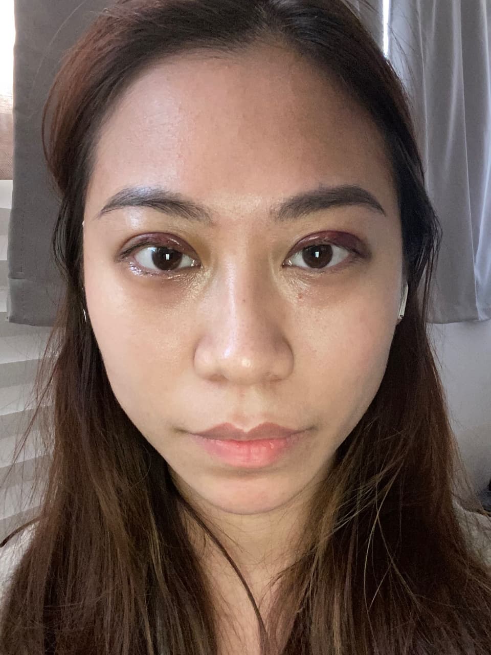 #分享 高雄割雙眼皮 - 醫美板 | Dcard