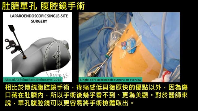 醫學的前輩們真的很猛，微創手術的進步 - 心情板 | Dcard