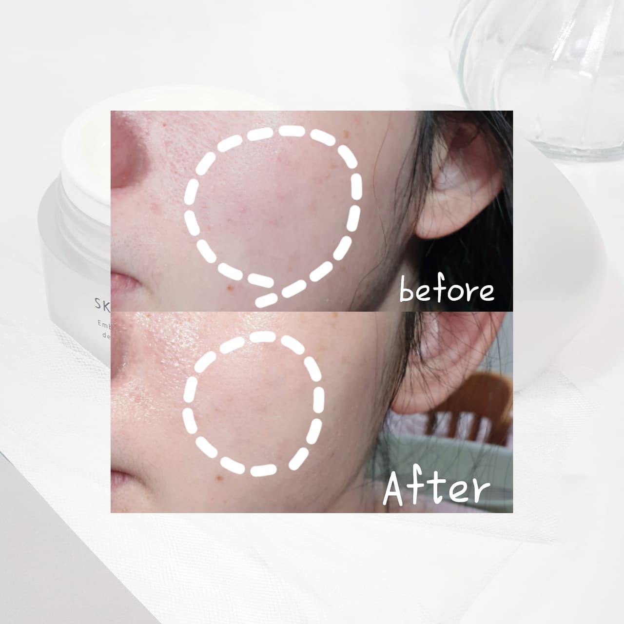 敏感肌必試！d program敏感話題保濕修復霜！#開箱大使 - 珍珠奶茶控🌷🌷🌷 (@hanhan____) | Dcard