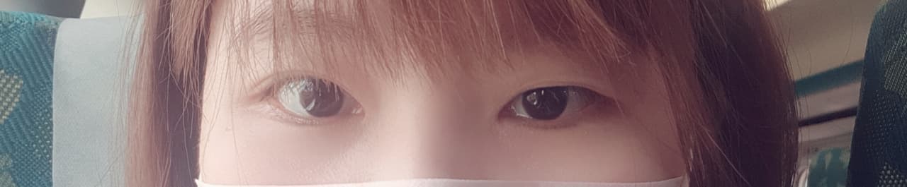 雙眼皮不專業解說-平行型 - B81 留言 | Dcard