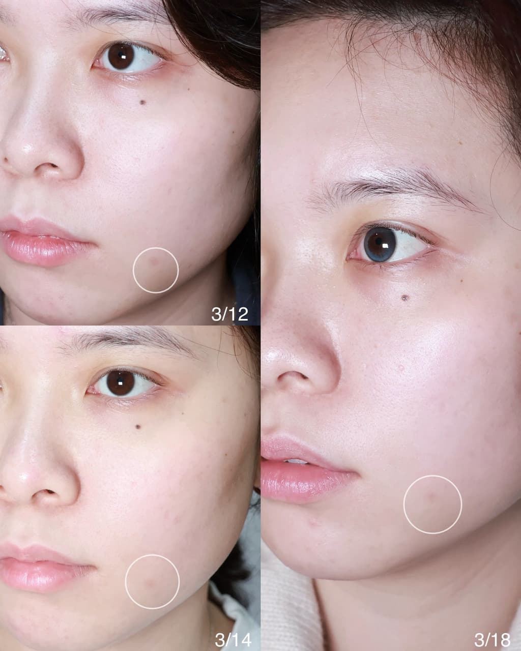 #分享 極光水變得更厲害了⁉️｜蘭蔻超級極光水 - 雞腿小公主 (@rei_1998) | Dcard