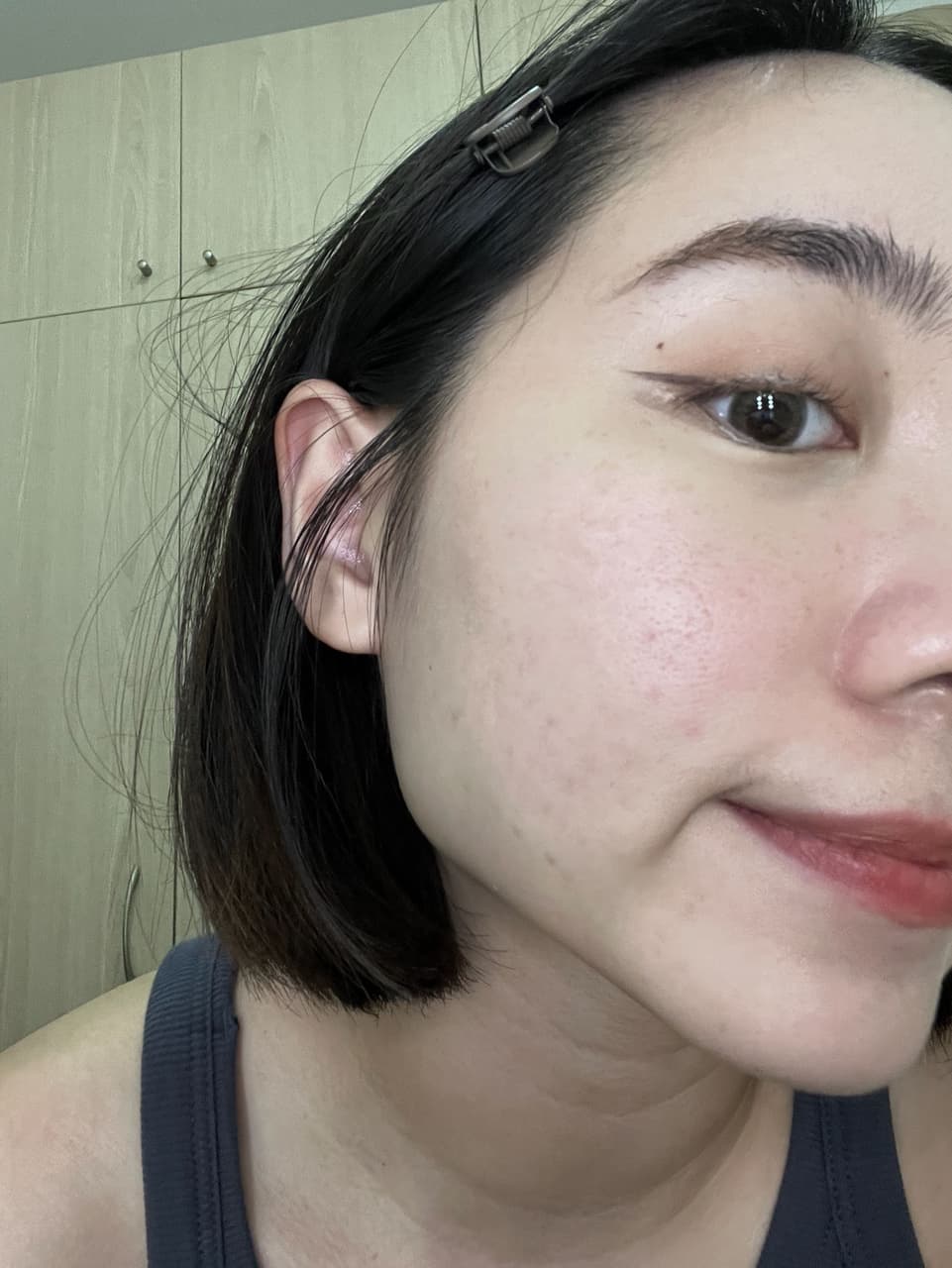 #分享 酒糟抗痘之路太苦了！花了一年養出穩定肌 - B111-1 留言 | Dcard