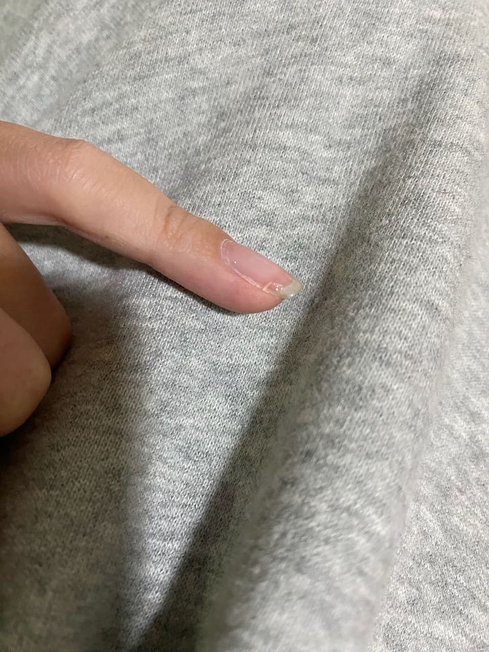 問題 指甲斷掉 求救 美甲板 Dcard