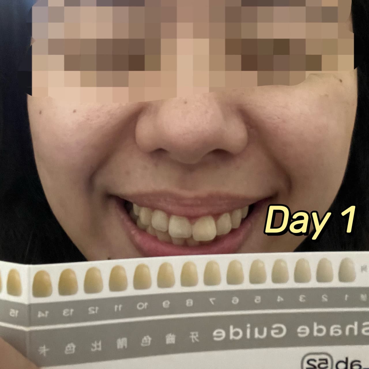 Lab52齒妍堂美齒面膜7天實測心得 (圖多) - 美妝板 | Dcard