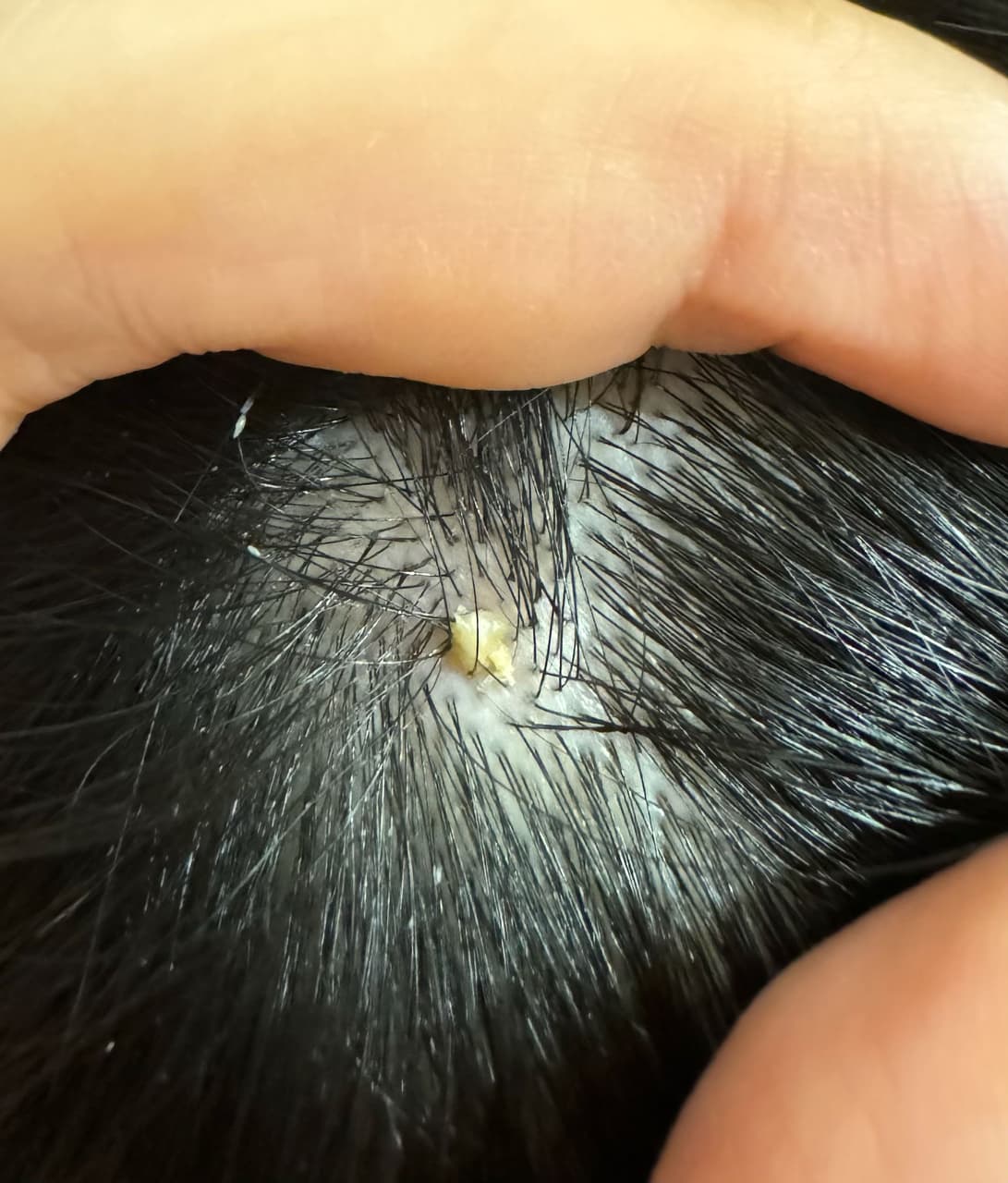 頭皮的黑洞 - B23 留言 | Dcard