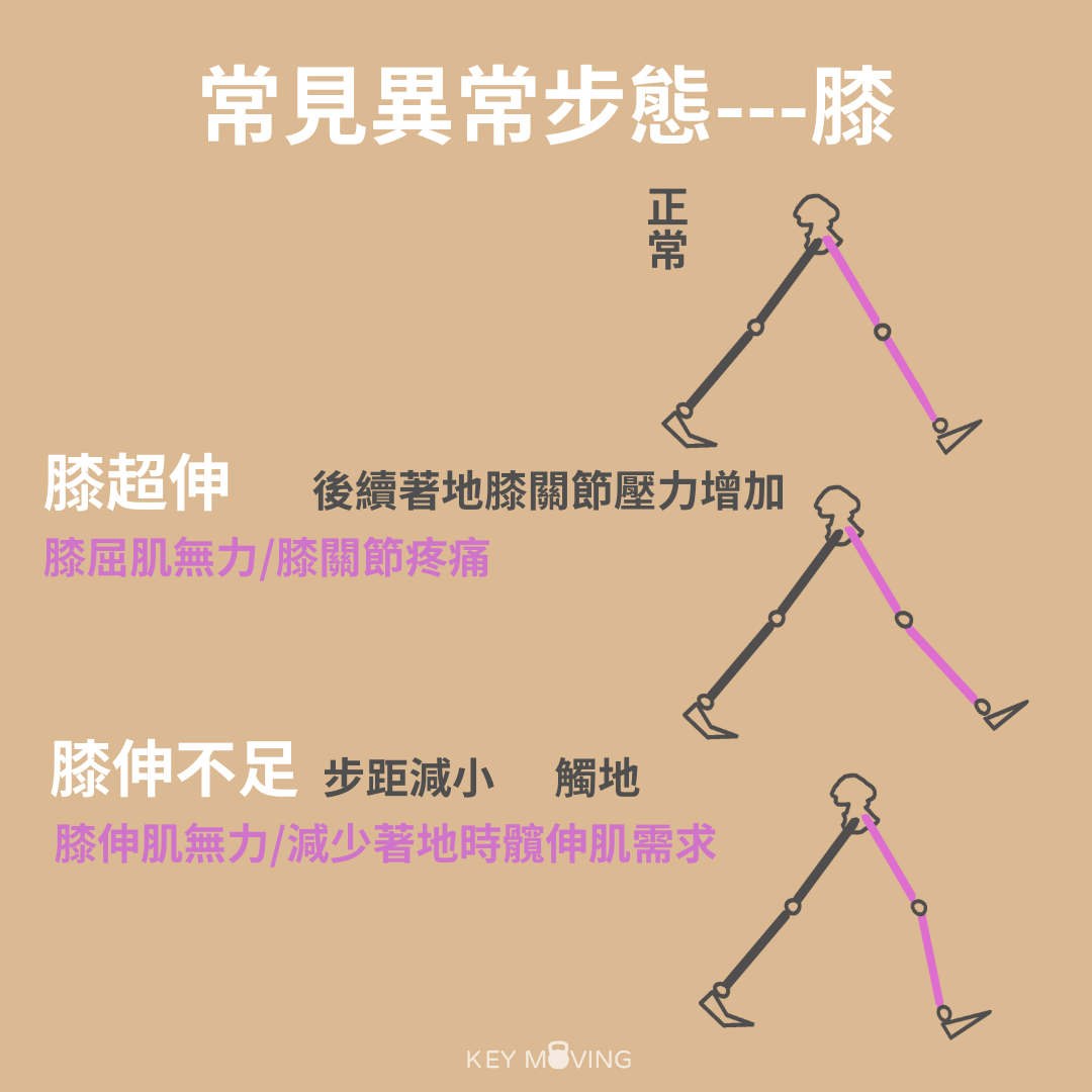 步態分析的最後一哩路 - 還有夢想的物理治療師 (@bo_soul) | Dcard