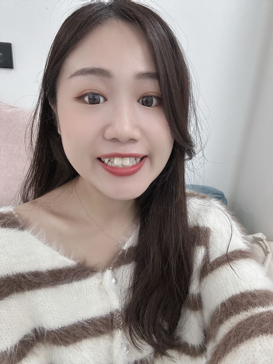 #請益 求助下個月要拆牙套了，幫幫看🥹 - 牙齒矯正板 | Dcard