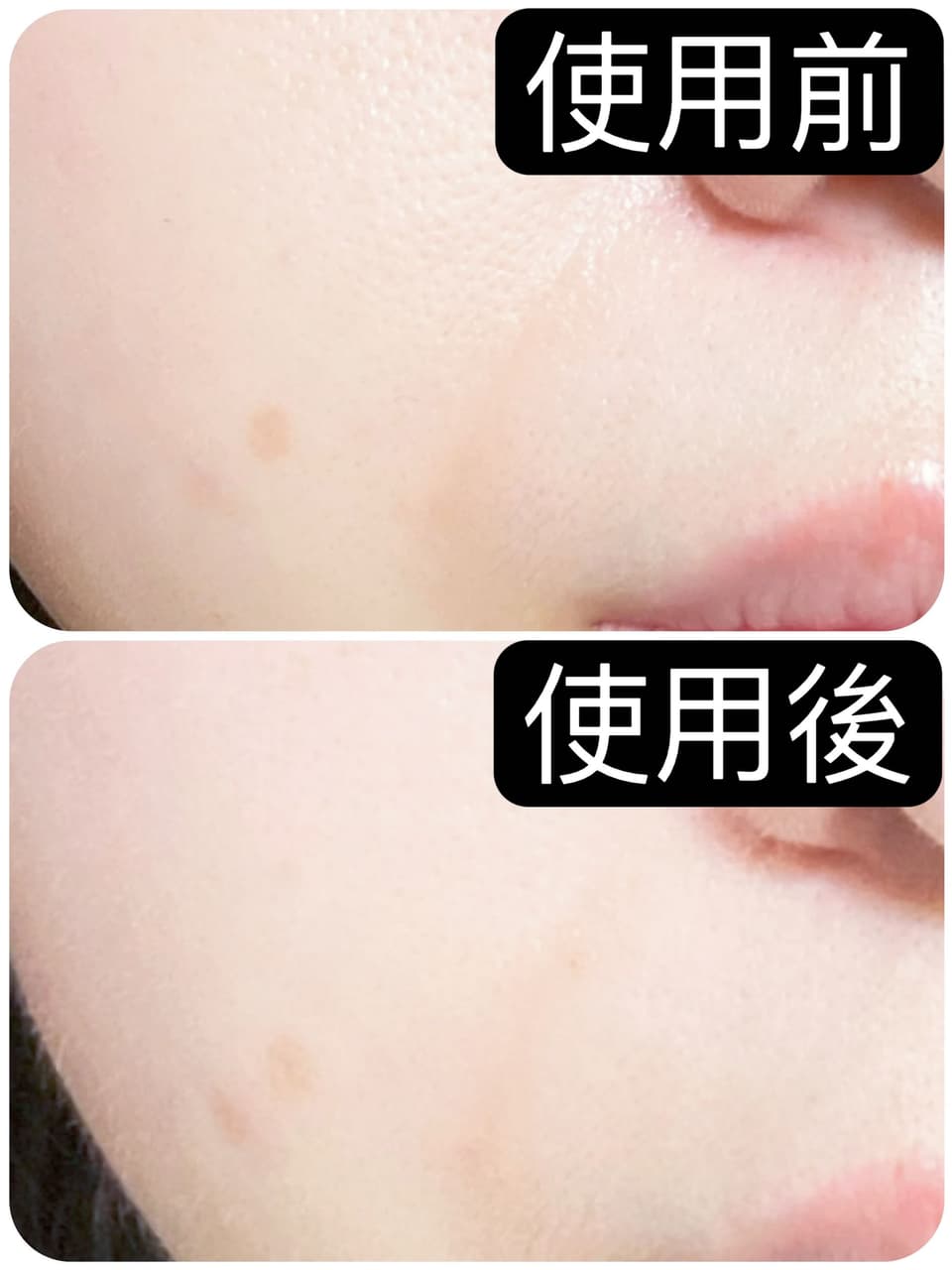 黑繃帶平替!開架最強撫紋霜 紫熨斗PRO 開箱! ft.巴黎萊雅 - 木木 (@dmlu) | Dcard