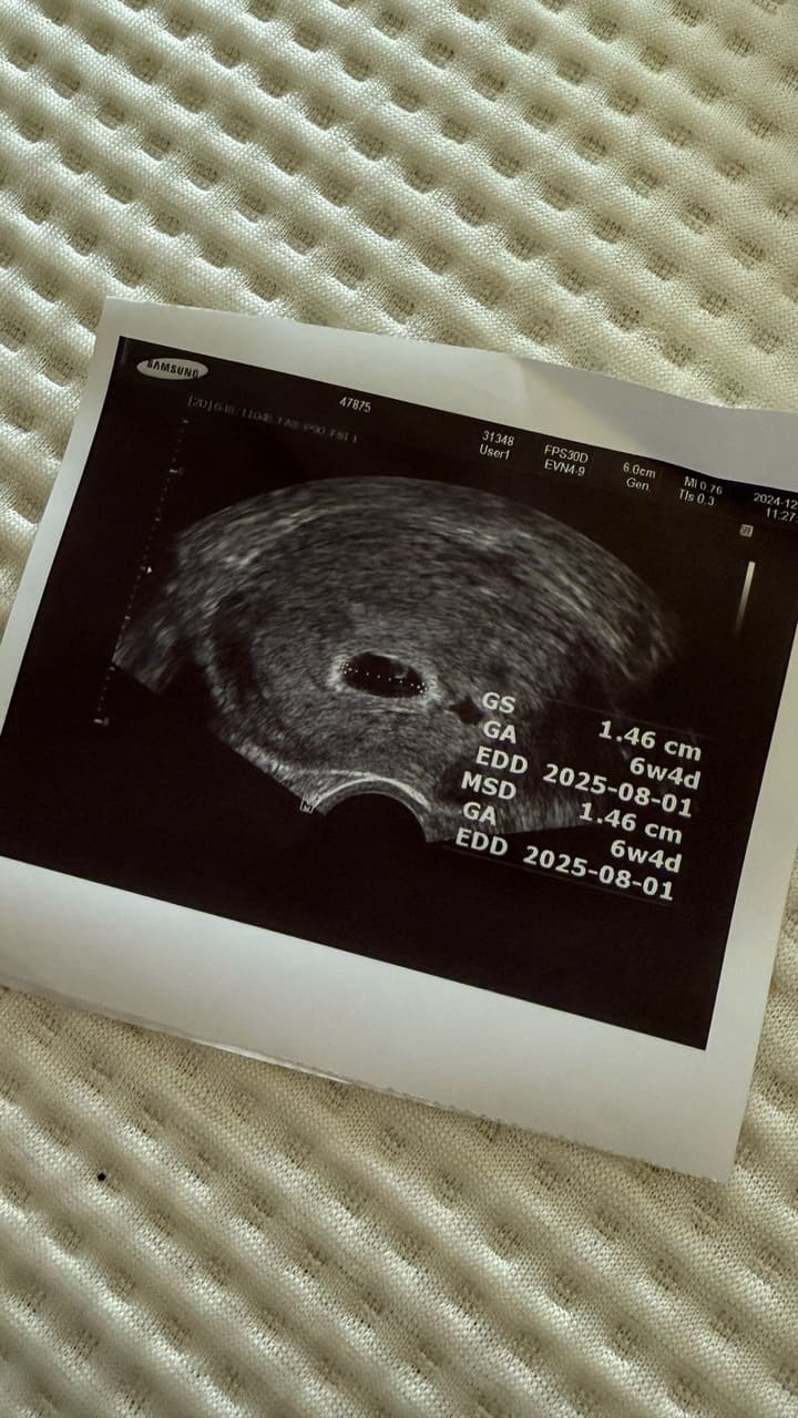 #懷孕 紀錄6w4d - 親子板 | Dcard