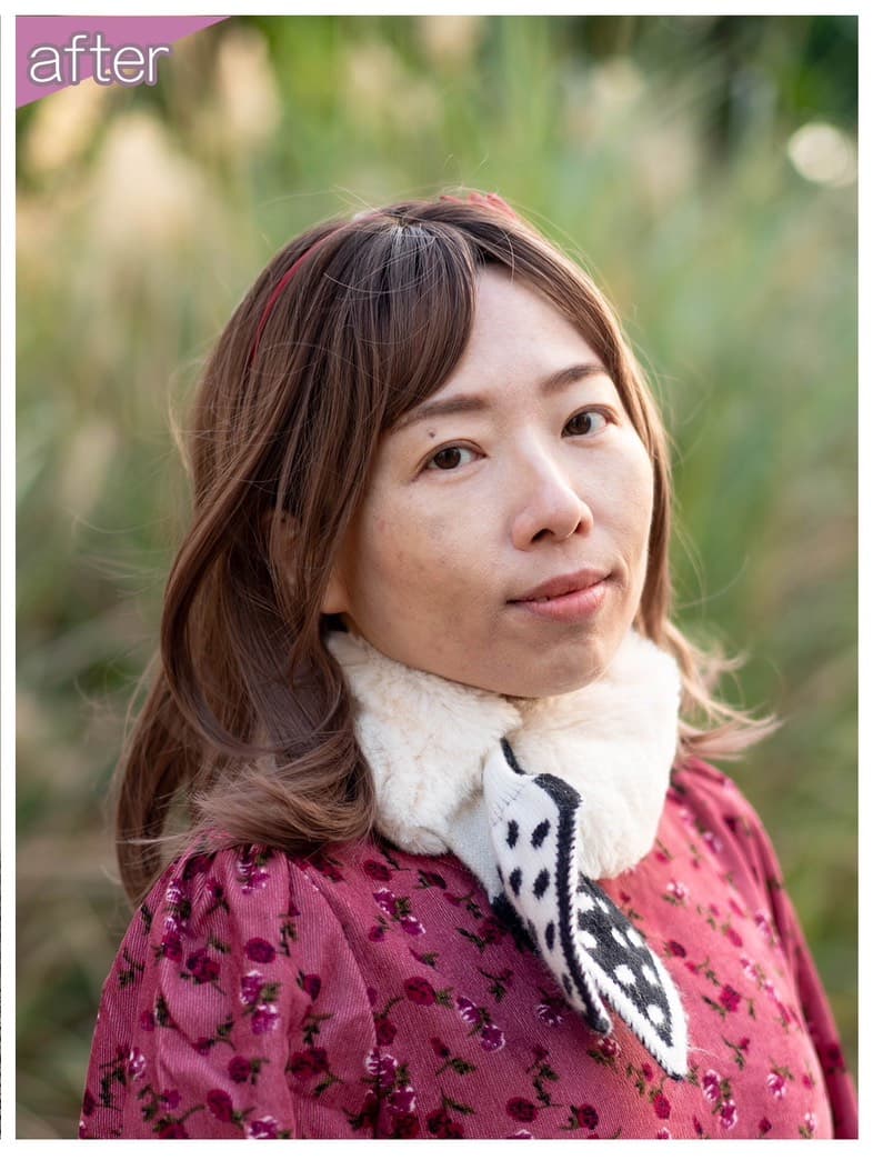 告別痘痘、蠟黃等肌膚問題 邁向素顏健康美肌 - 十分肌膚管理 (@skin_beauty_10) | Dcard