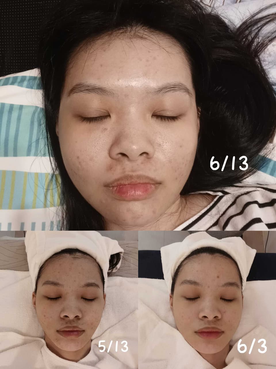 #分享 台中平價美容 男生清粉刺 - 美妝板 | Dcard