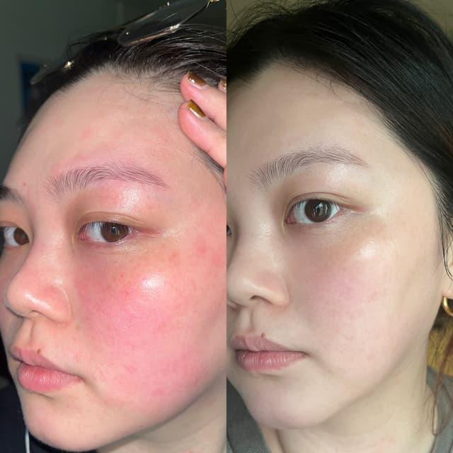 #分享 最近很紅的日本SHIMBI METHOD?! 我花錢幫你試 - 美妝板 | Dcard