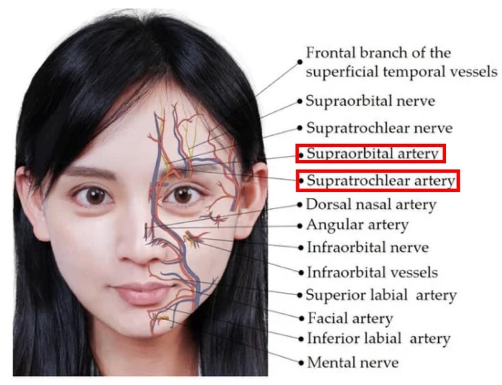 #分享 洢蓮絲是不是不能填充額頭呢? 填充的層次與技術還是關鍵所在 - 醫美板 | Dcard