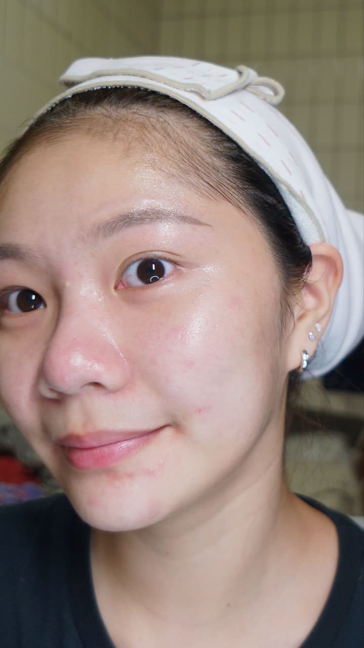 痛一下皮膚就變好了？！VT微晶精華超厲害！ - Van (@van.vanmake) | Dcard