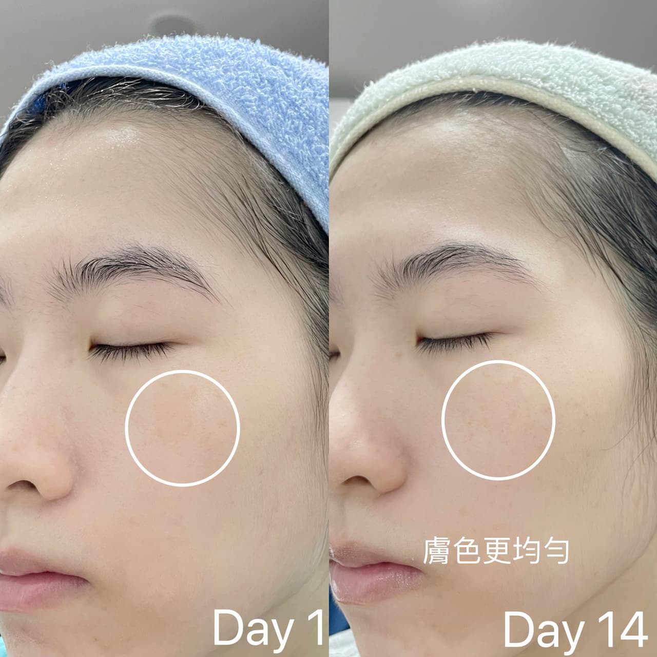 解鎖日本女生的白玉肌 ft.SHIMBI METHOD審美之選👶🏻 - Anita🍎 (@anitachen27) | Dcard