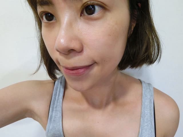 #分享 喬雅登玻尿酸初體驗！臉終於變澎潤了 - 醫美板 | Dcard