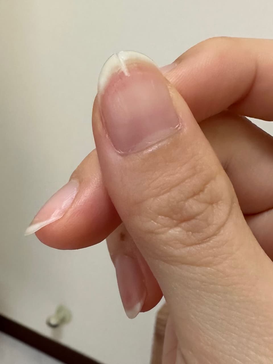 問題 指甲縱向裂開 美甲板 Dcard