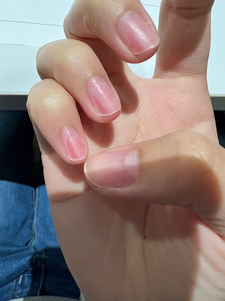 分享 這樣是受傷了嗎 美甲板 Dcard