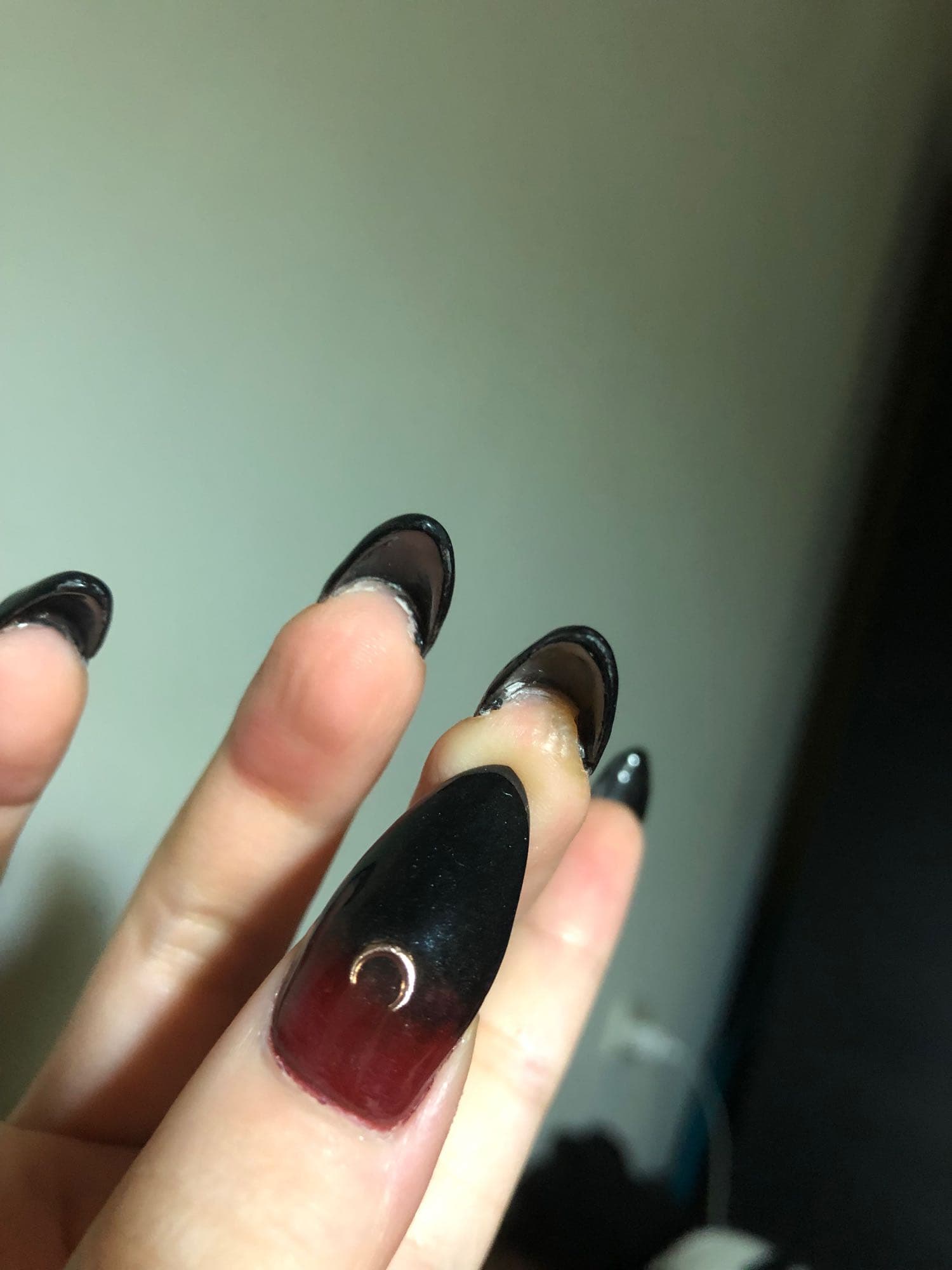 手指長水泡發霉 美甲板 Dcard
