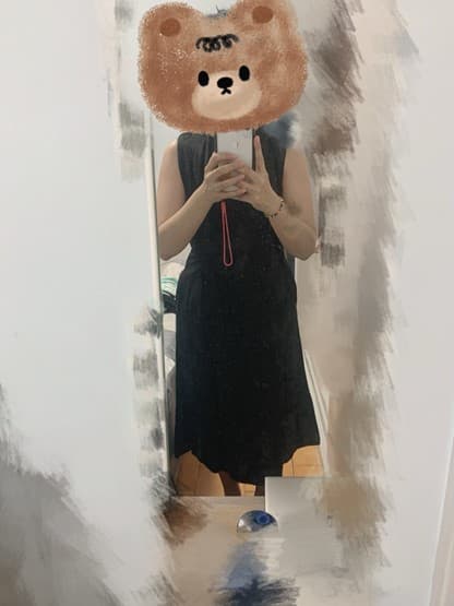 分享想要的纖細手臂 - 晶美整形 (@skin1000) | Dcard