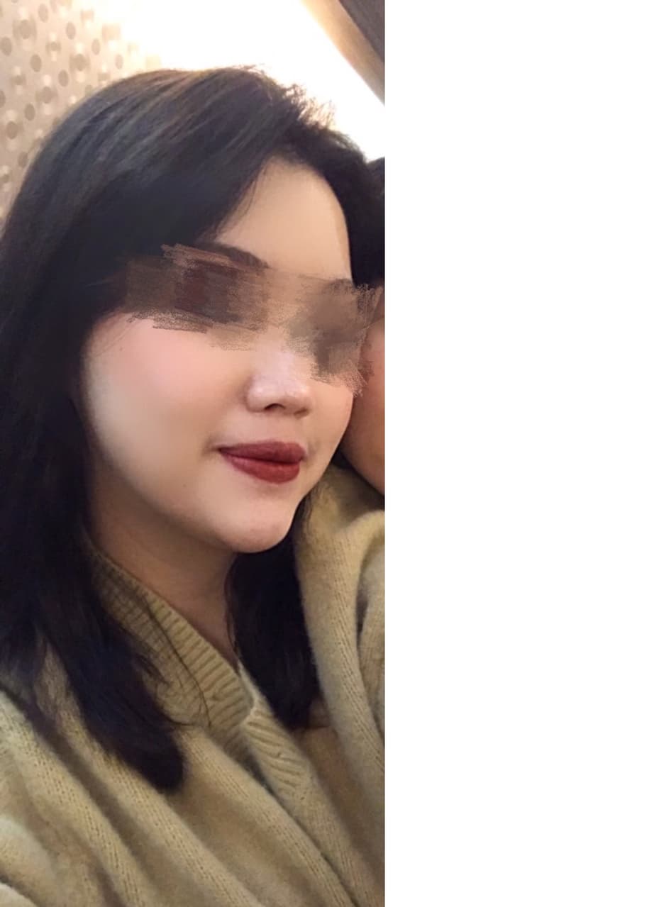 #分享 推！海芙音波分享心得 下巴線條變好好看阿😍 - 醫美板 | Dcard