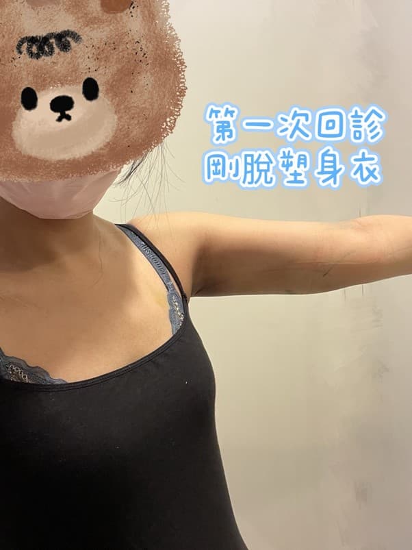 分享想要的纖細手臂 - 晶美整形 (@skin1000) | Dcard