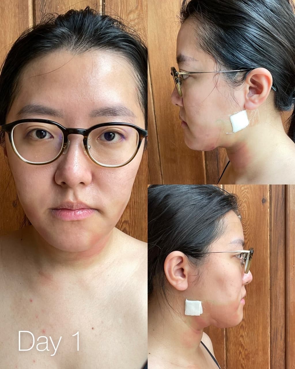 #分享 終於找回我的輪廓線 雙下巴消失全紀錄!! - 狂愛日本的女紙 (@der0311) | Dcard