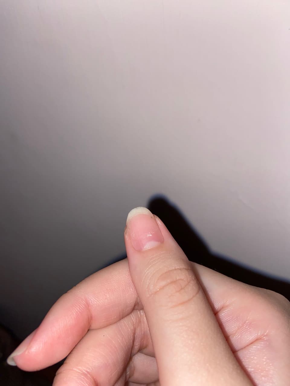 已解決 自己diy卸甲,想請問這樣是沒有卸乾淨嗎? 美甲板 Dcard