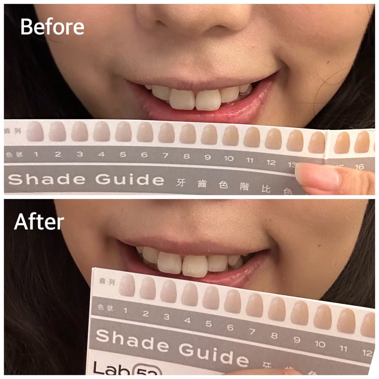 #開箱 #開箱 7天就讓牙齒變白6個色階！Lab52齒妍堂美白抗染雙效組合 #開箱大使 - 美妝板 | Dcard