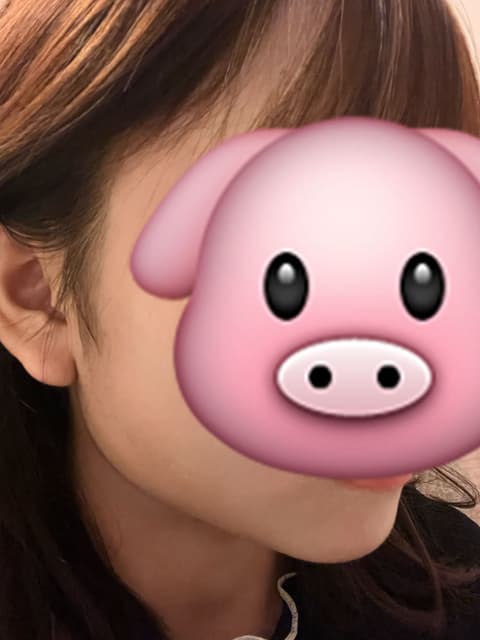 詢問 請問我的臉這樣很方嗎 醫美板 Dcard