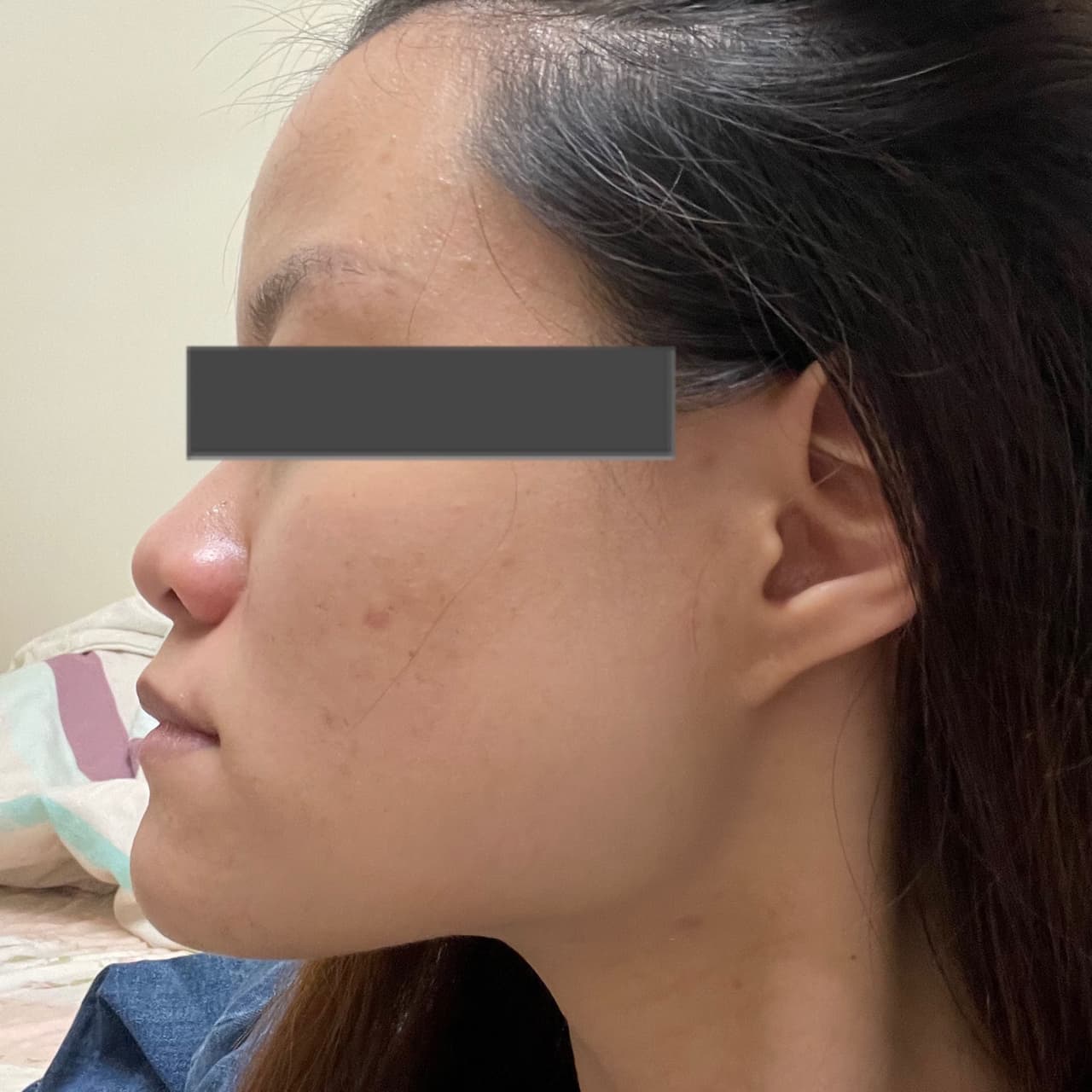 #分享 #更 我去削骨了！方臉bye bye - B144 留言 | Dcard