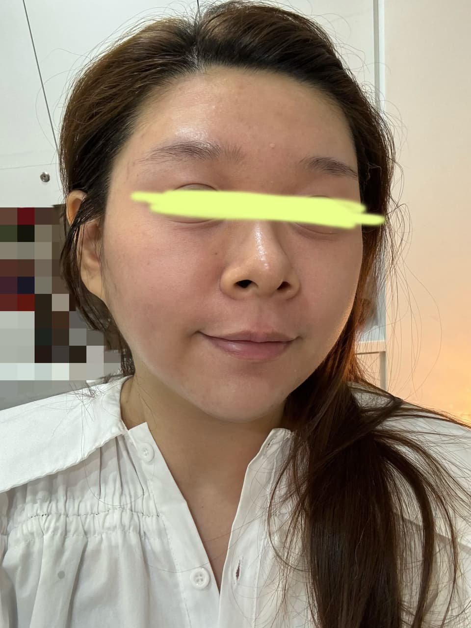 #分享 風很大的十倍電波體驗心得！ - 醫美板 | Dcard