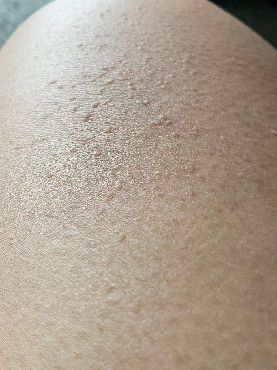 發問 這個到底是什麼 問答板 Dcard