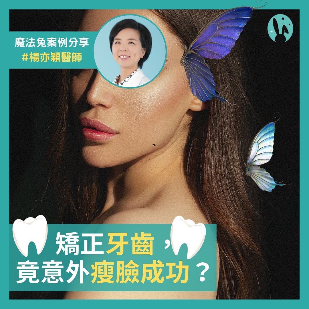 矯正牙齒，竟意外瘦臉成功？| 魔法兔健康冷知識【衛教案例故事分享】 - 舊「魔法兔健康冷知識」 (@magictooth) | Dcard