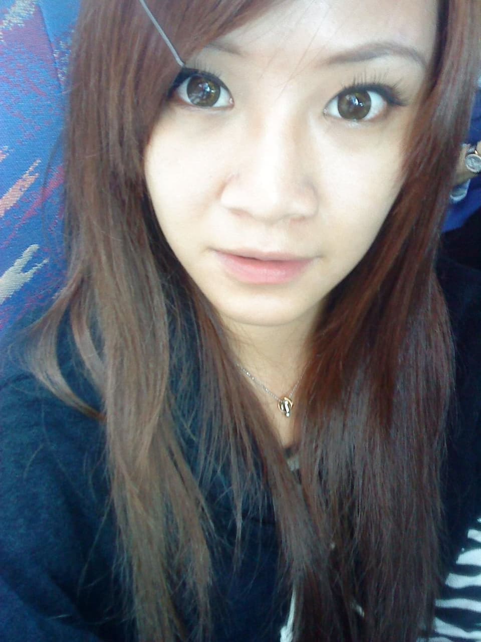 #分享 雙眼皮術後分享 - 醫美板 | Dcard