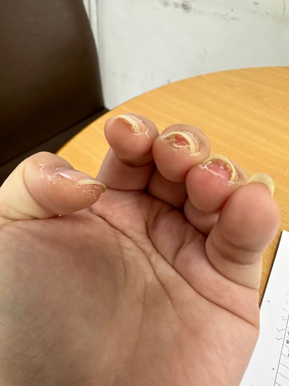 問題 詢問手這樣是怎麼回事? 美甲板 Dcard