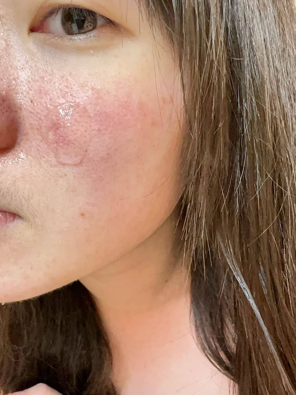 敏感肌也能放心使用！溫和有感 d program淨荳益生精華😌 - 珍珠奶茶控🌷🌷🌷 (@hanhan____) | Dcard