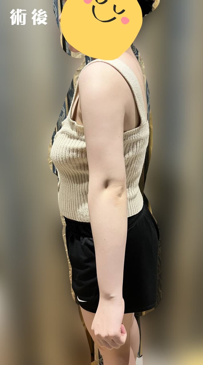 #分享 想在婚禮上穿好看的禮服當個漂亮的新娘子！ - 晶美整形 (@skin1000) | Dcard