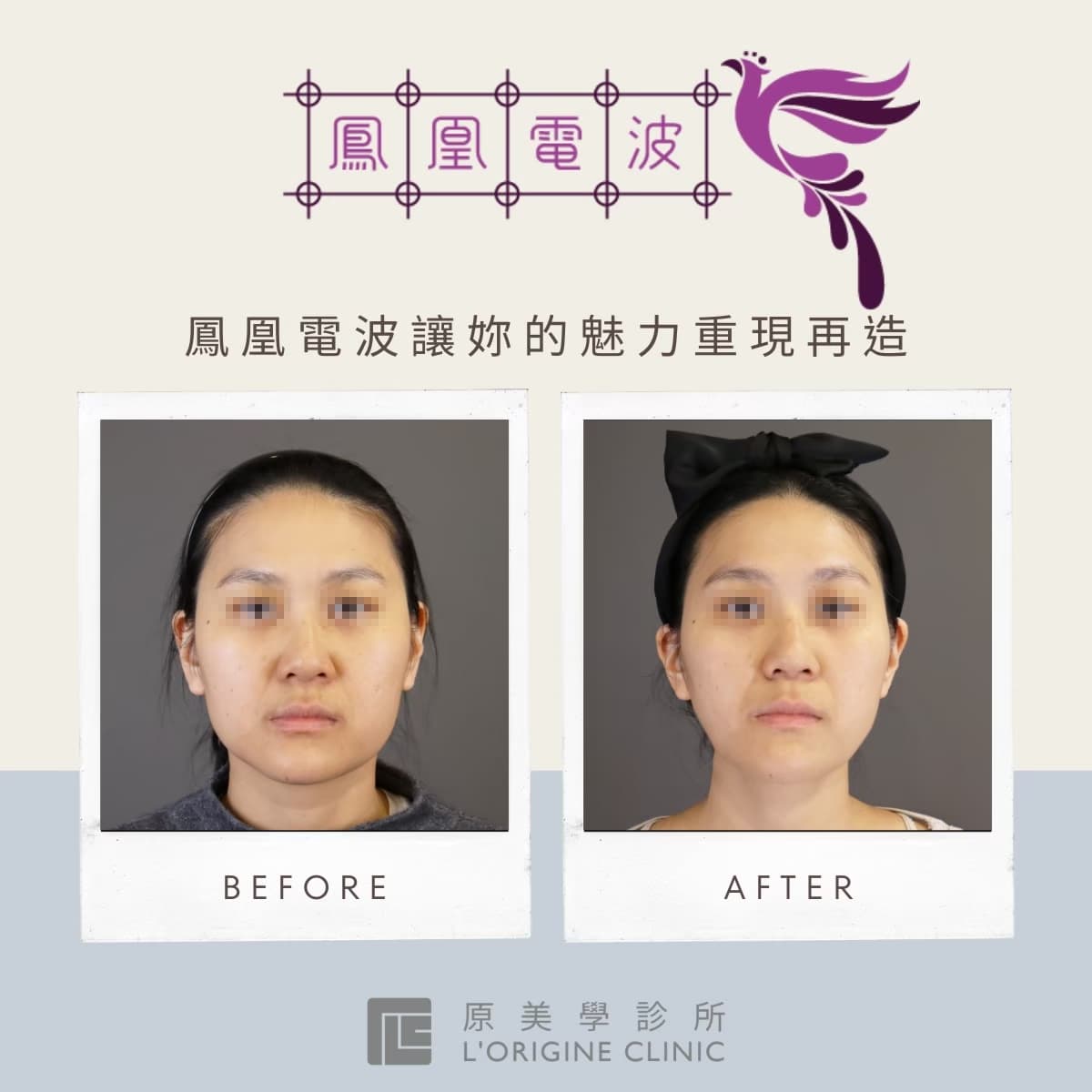 #知識 體重減輕了皮膚卻變鬆？ - 原美學診所 (@lorigine) | Dcard