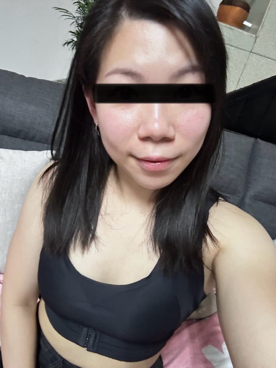 #詢問 有姐妹這樣嗎？ - 醫美板 | Dcard