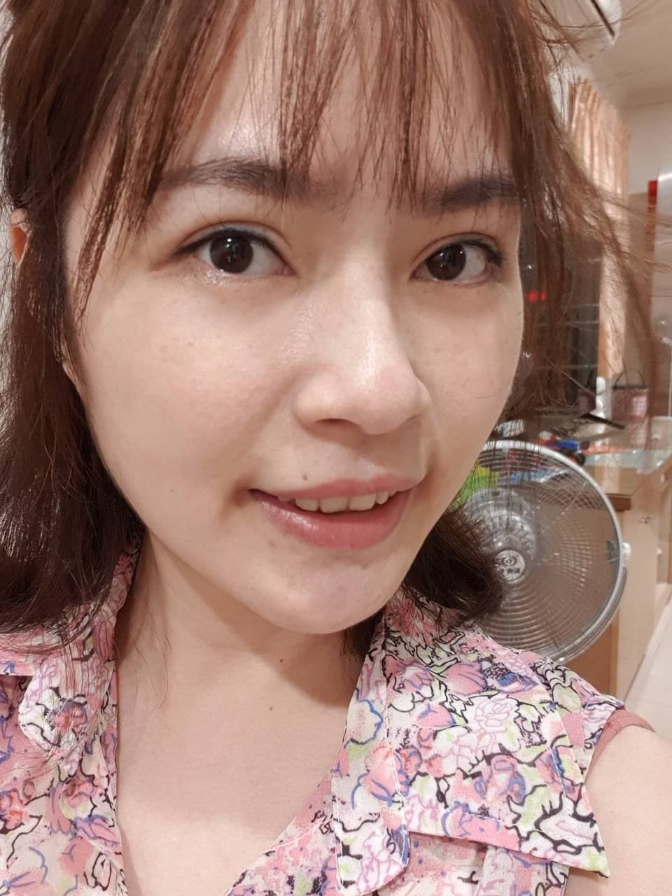 #分享 跟眼睛一樣大的眼袋再會拉😆 - 醫美板 | Dcard