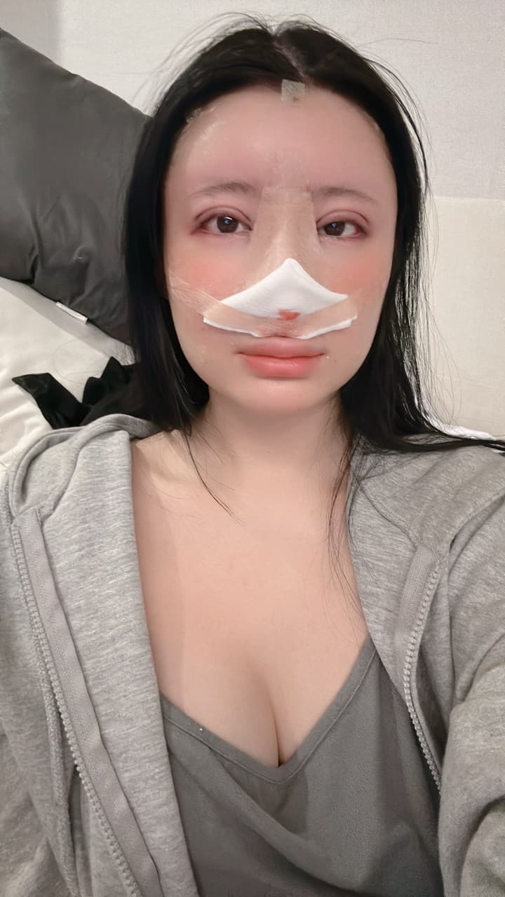 #分享 普妹爆改後媽系Coser💥看我女大十八變 - 醫美板 | Dcard