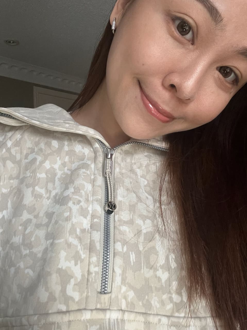 加入Dcard後做的醫美總整理+心得😳#我的Dcard時光 - 自由媳 (@freeee_na) | Dcard