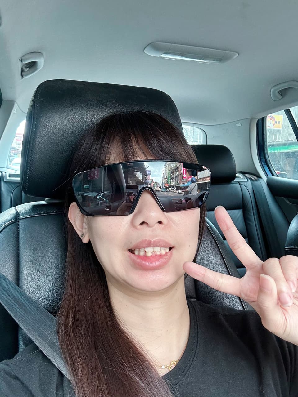 #分享 近視雷射 - 醫美板 | Dcard