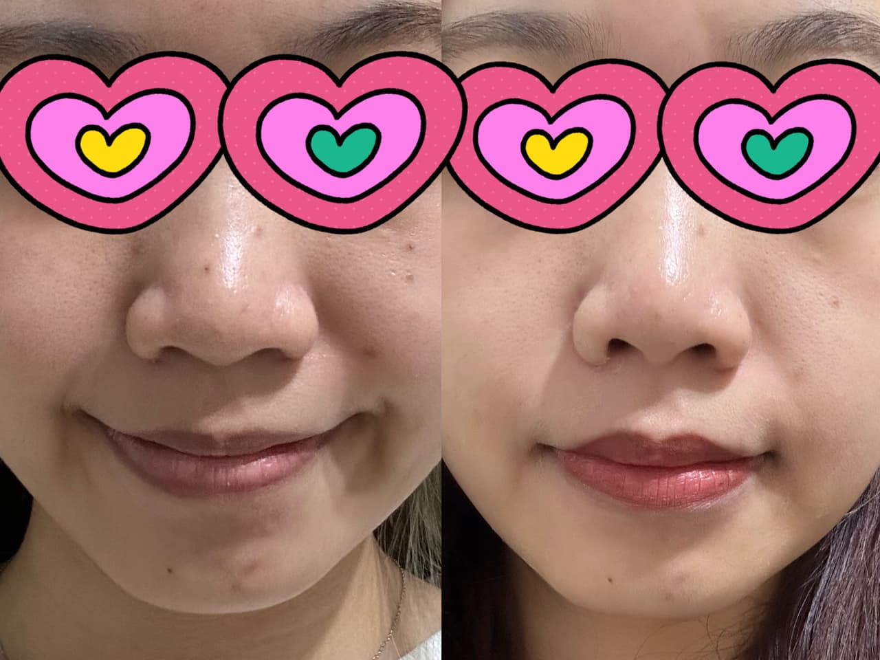 #分享 #好物推薦 『La Glow法令紋撫紋霜（溫和版）』 - 美妝板 | Dcard