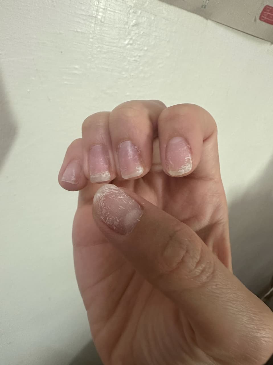 問題 指甲變薄變翹 美甲板 Dcard