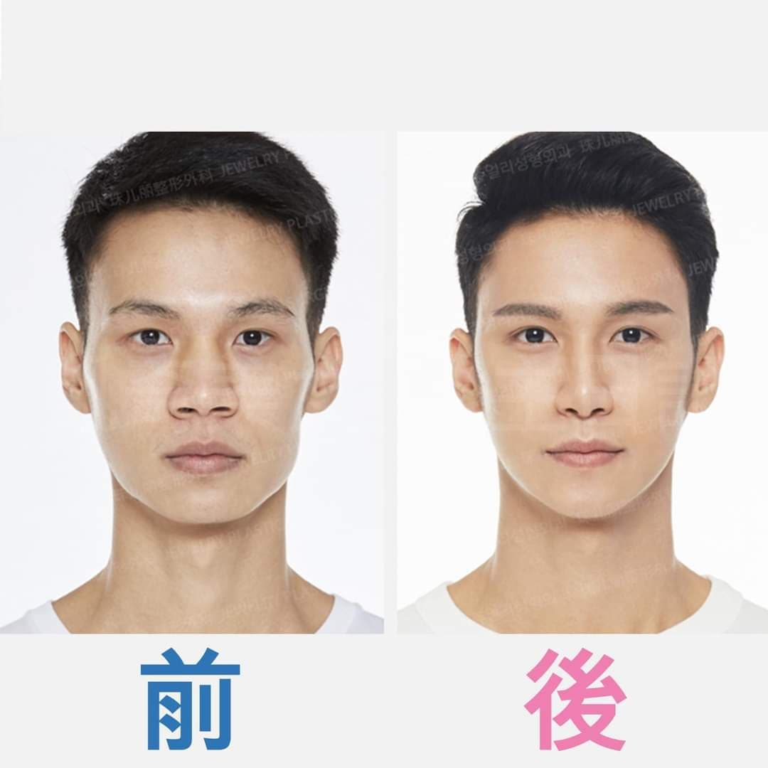 #詢問 為什麼台灣醫美這麼貴？ - 醫美板 | Dcard