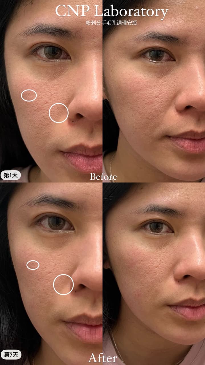 #分享 大毛孔星人帶你見證奇蹟! ㅣCNP Laboratory - 美妝板 | Dcard
