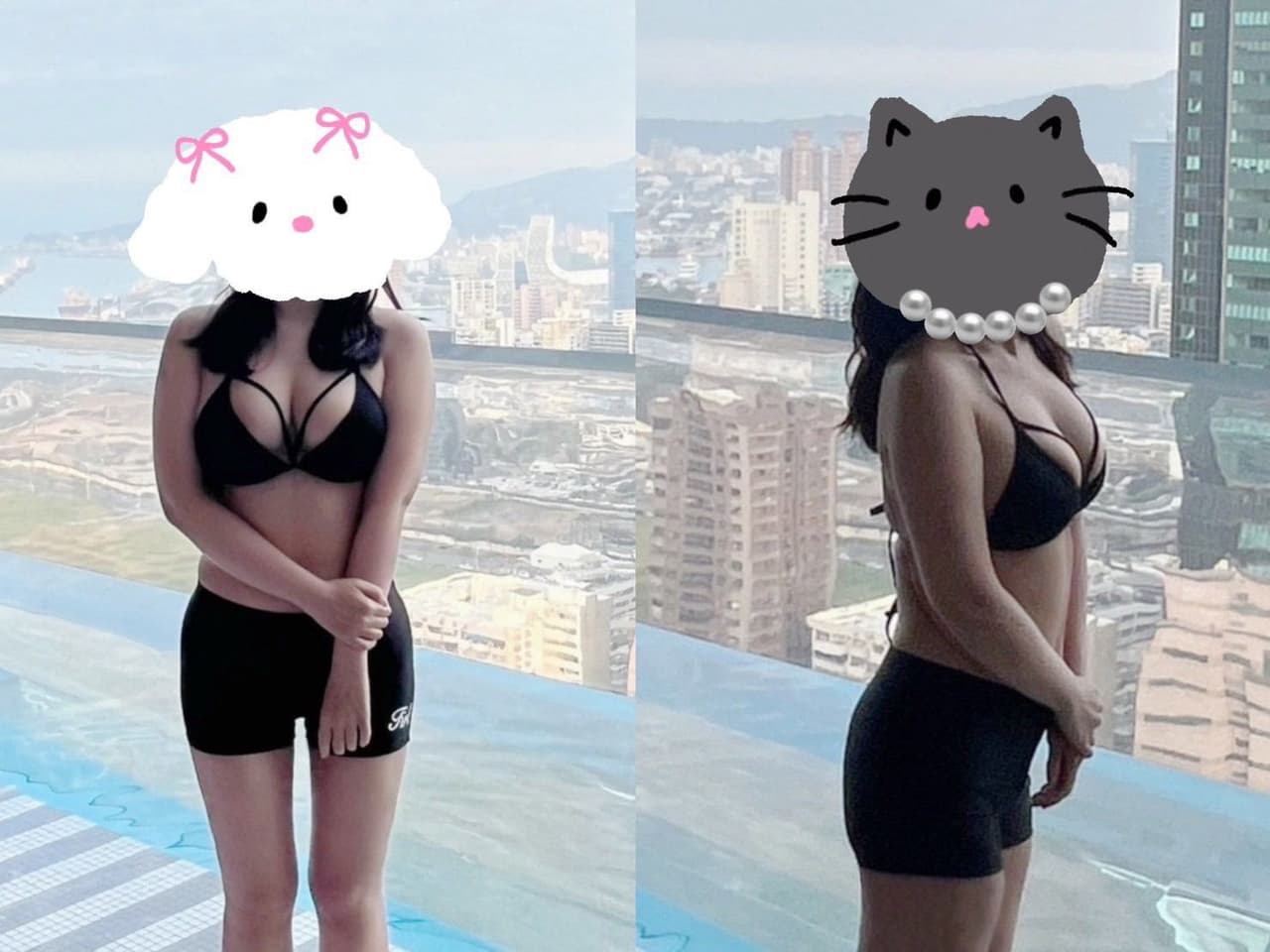 #分享 大小腿抽脂&PRP補胸Part 2 - 醫美板 | Dcard