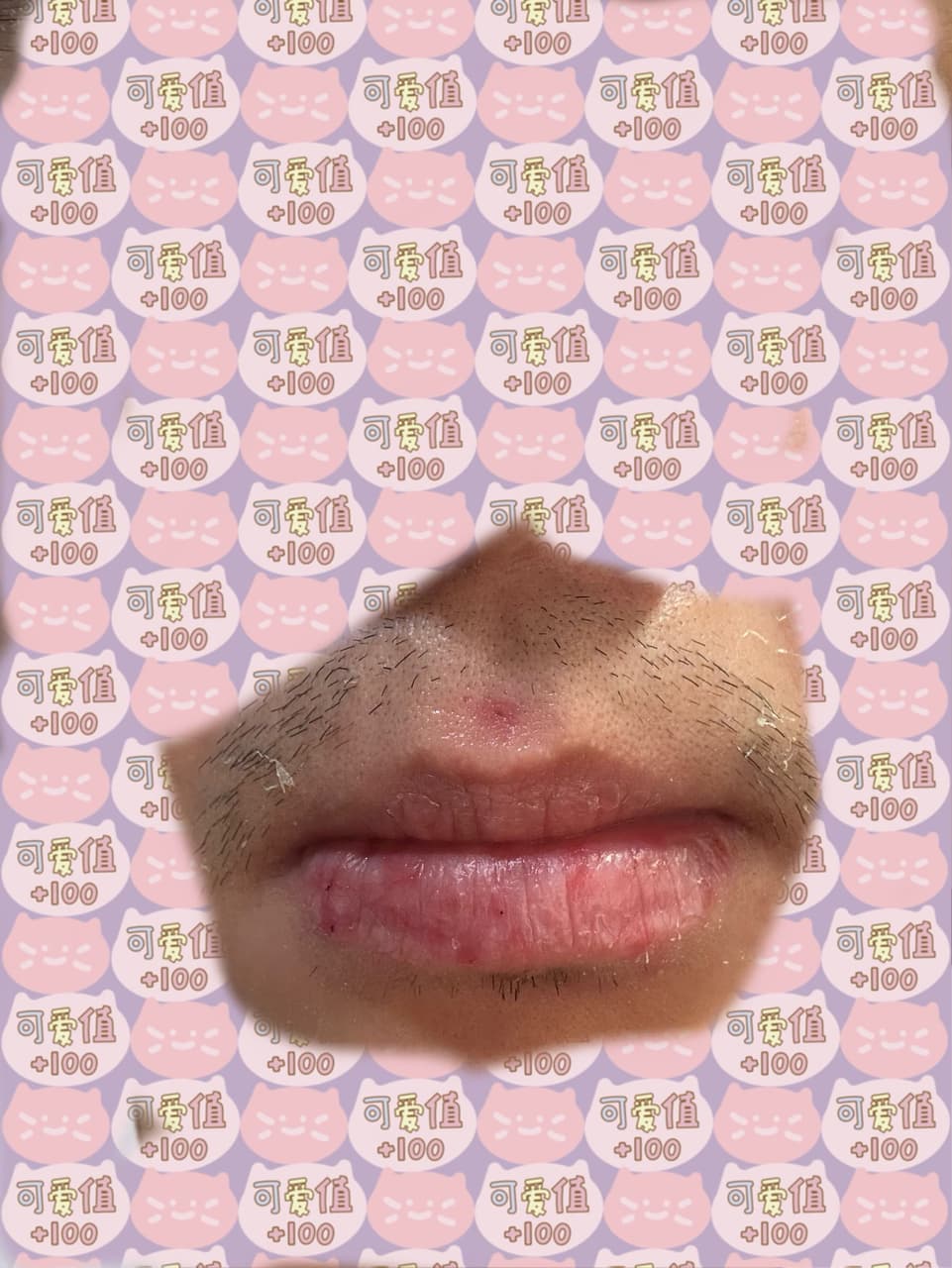 #分享 分享TCA治療痘疤 - B4-1 留言 | Dcard